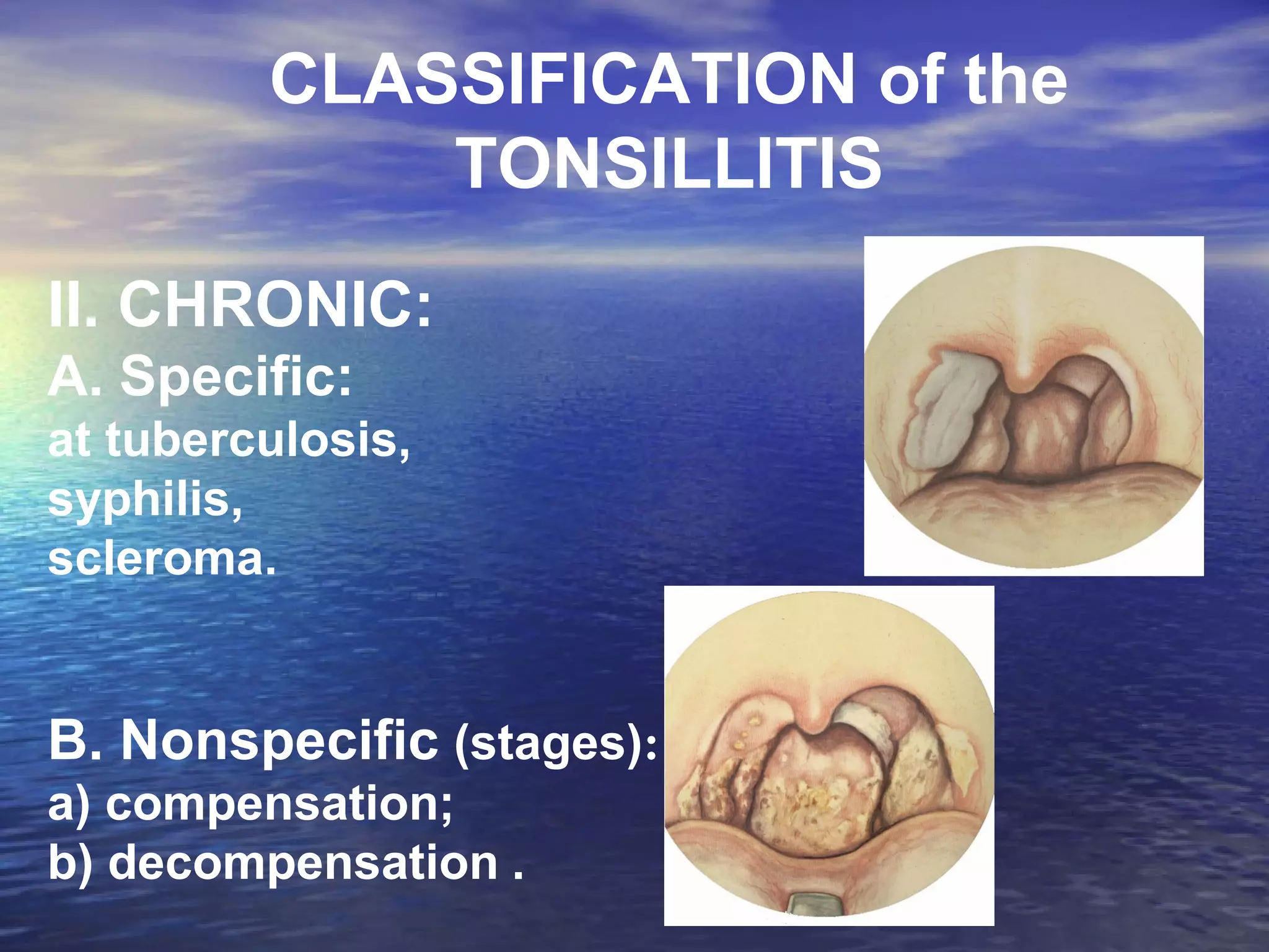Anatomy & Physiology of pharynx. Tonsillitis | PPT