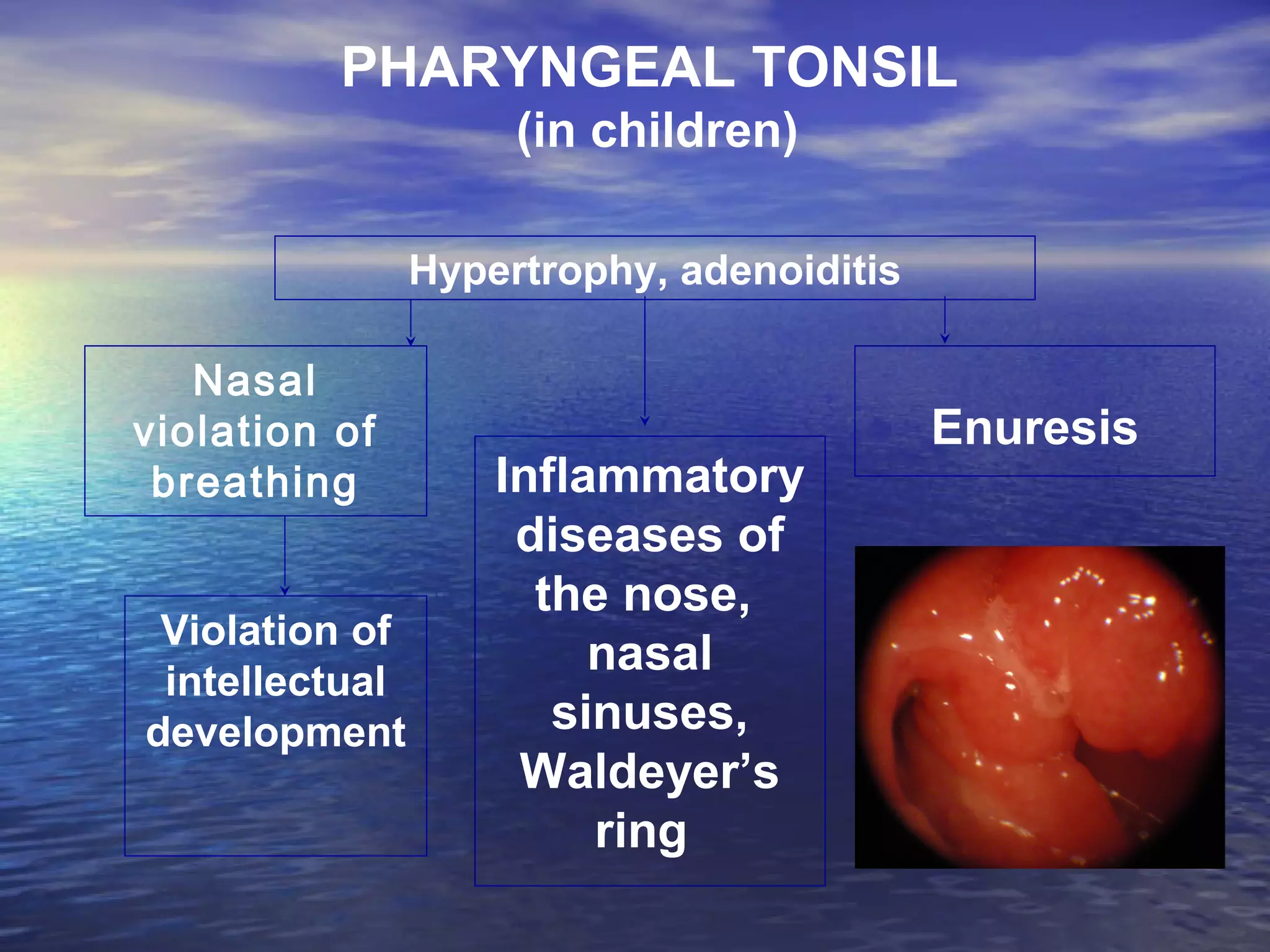 Anatomy & Physiology of pharynx. Tonsillitis | PPT