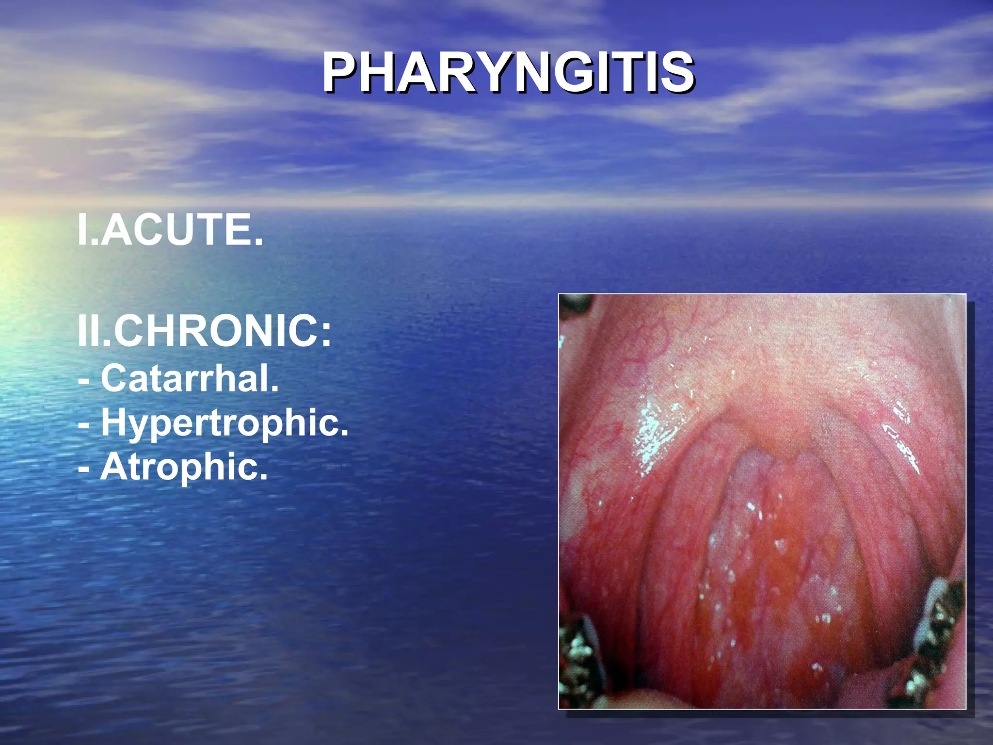 Anatomy & Physiology of pharynx. Tonsillitis | PPT