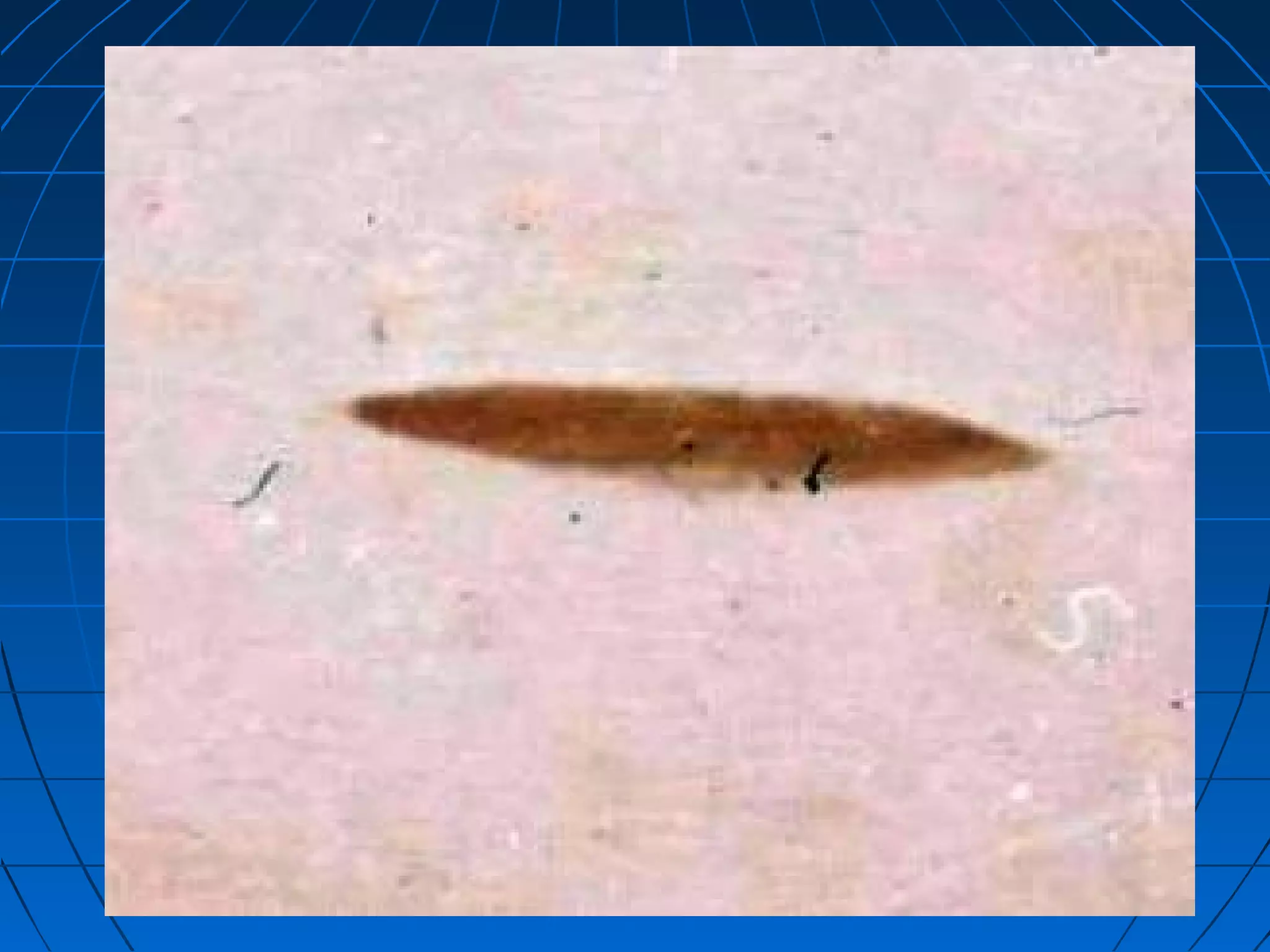 Damage by Sharp Objects | PPT