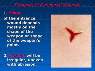 Damage by Sharp Objects | PPT