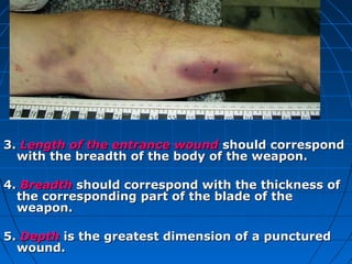 Damage by Sharp Objects | PPT