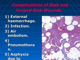 Damage by Sharp Objects | PPT