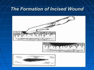 Damage by Sharp Objects | PPT