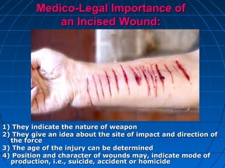 Damage by Sharp Objects | PPT