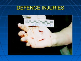 Damage by Sharp Objects | PPT