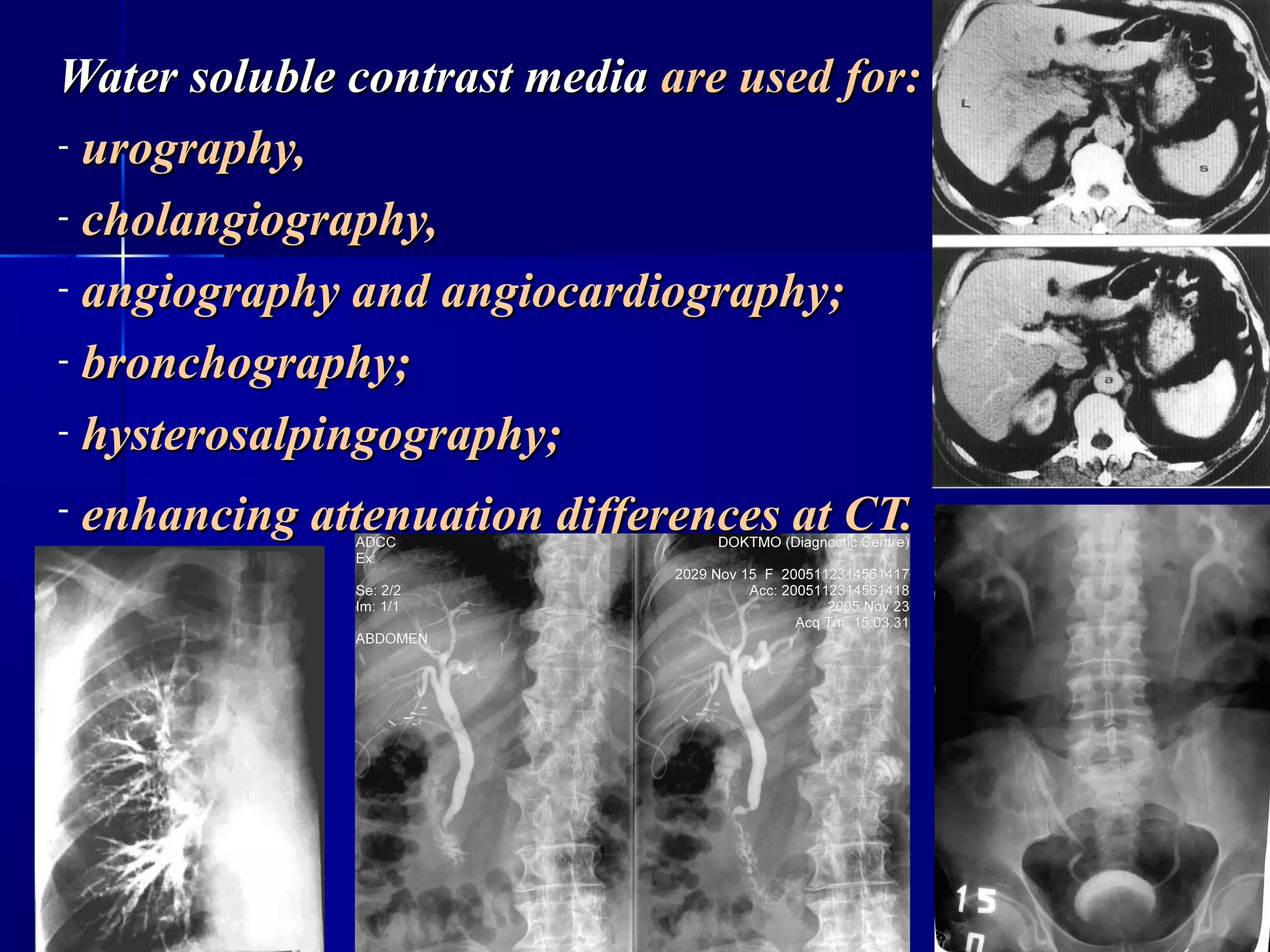 X-ray method of examination | PPT