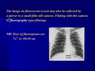X-ray method of examination | PPT