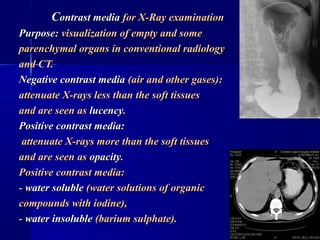 X-ray method of examination | PPT