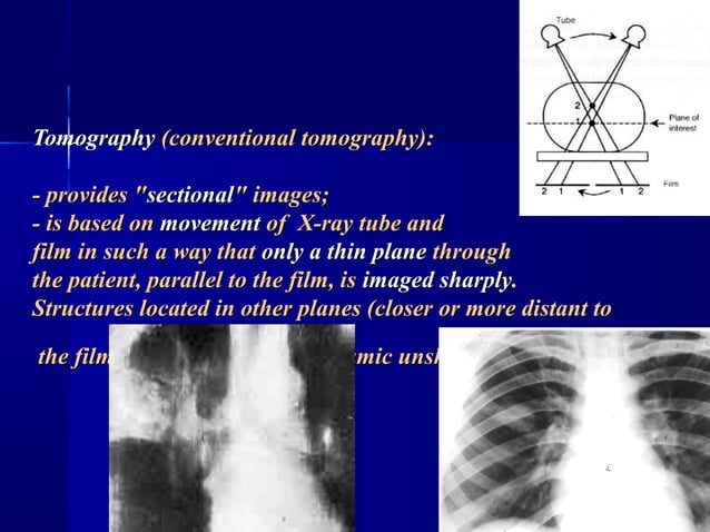 X-ray method of examination