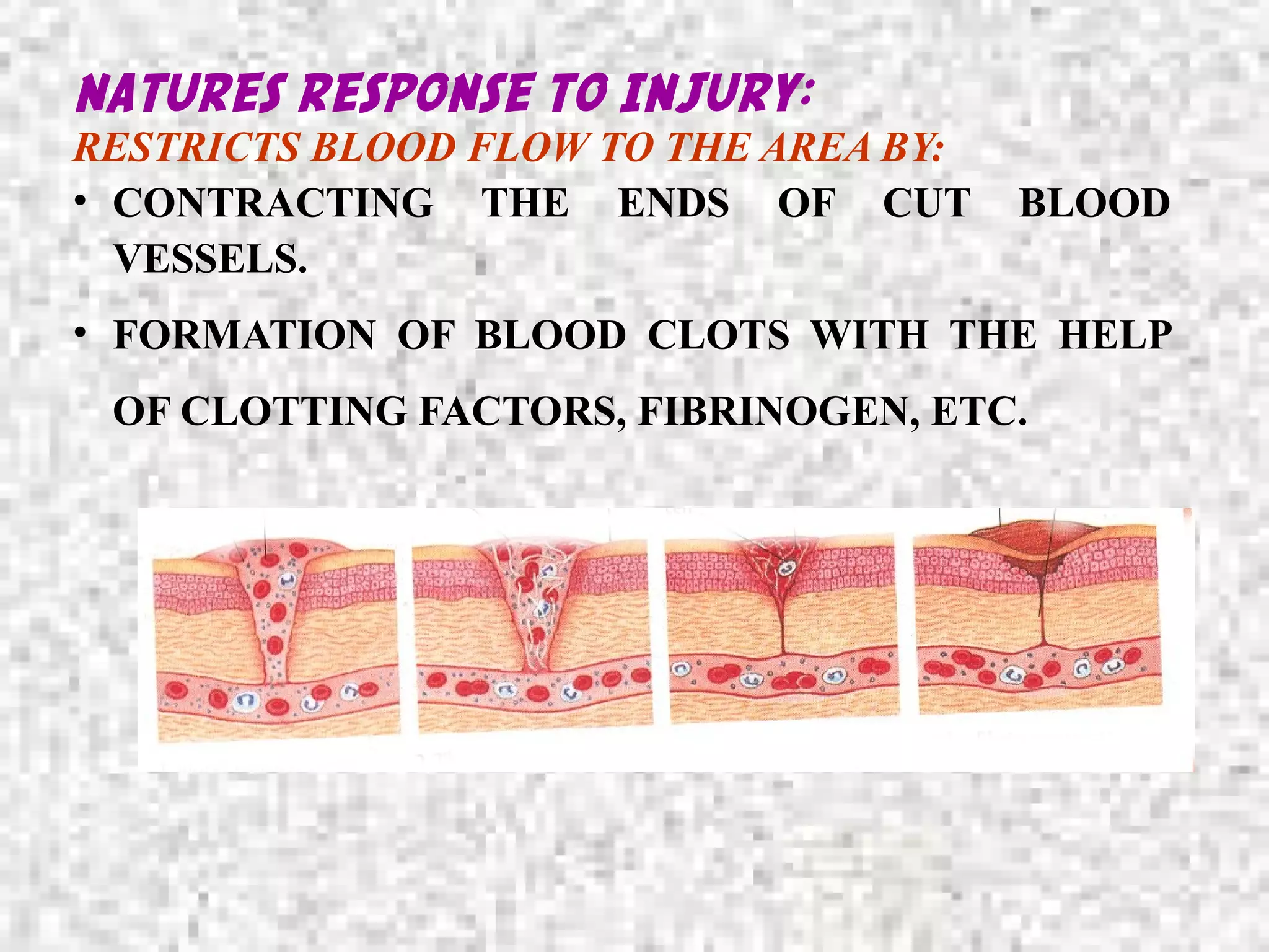 Wounds & Bleeding. Hemorrhage control | PPT