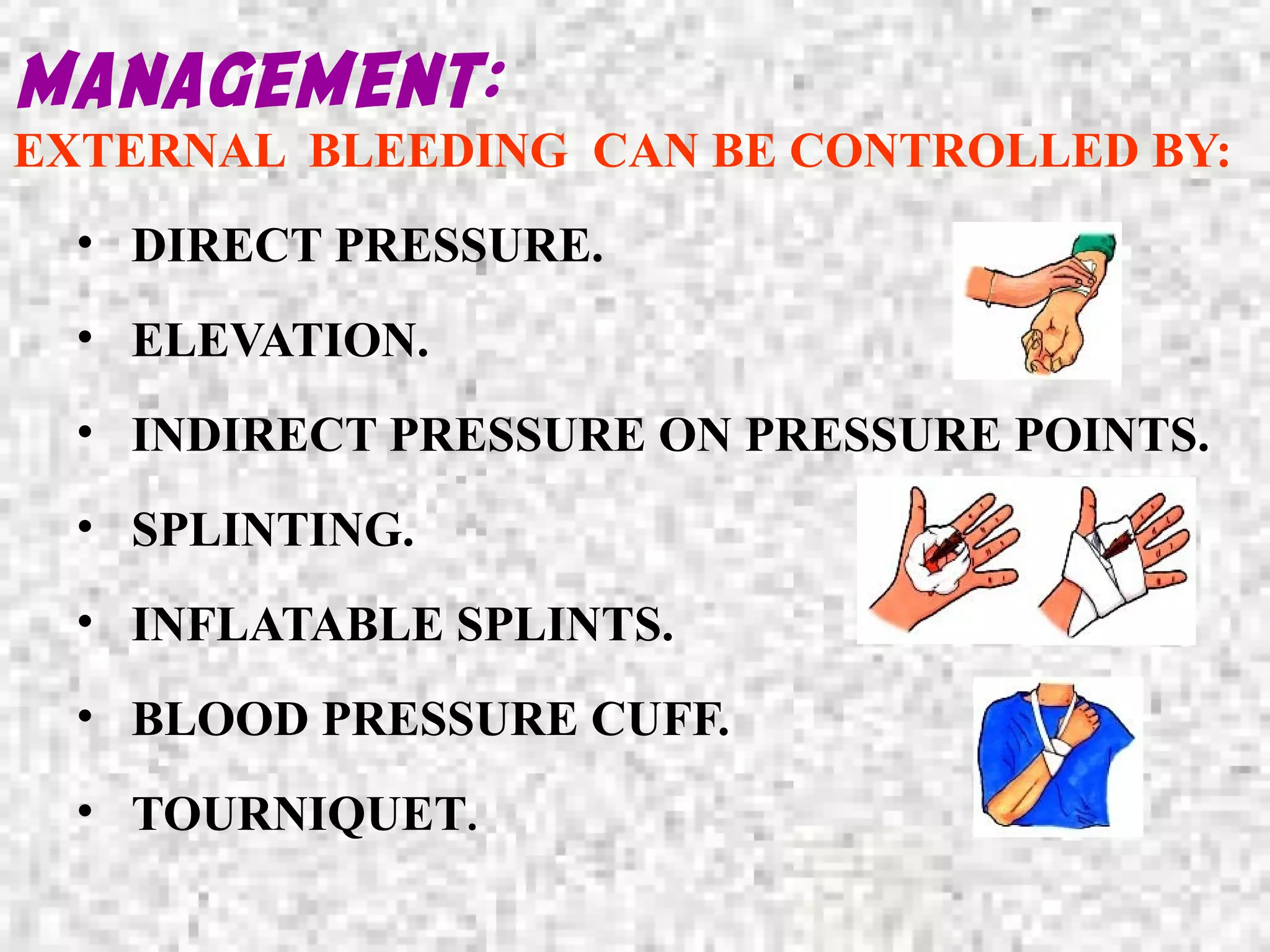 Wounds & Bleeding. Hemorrhage control | PPT