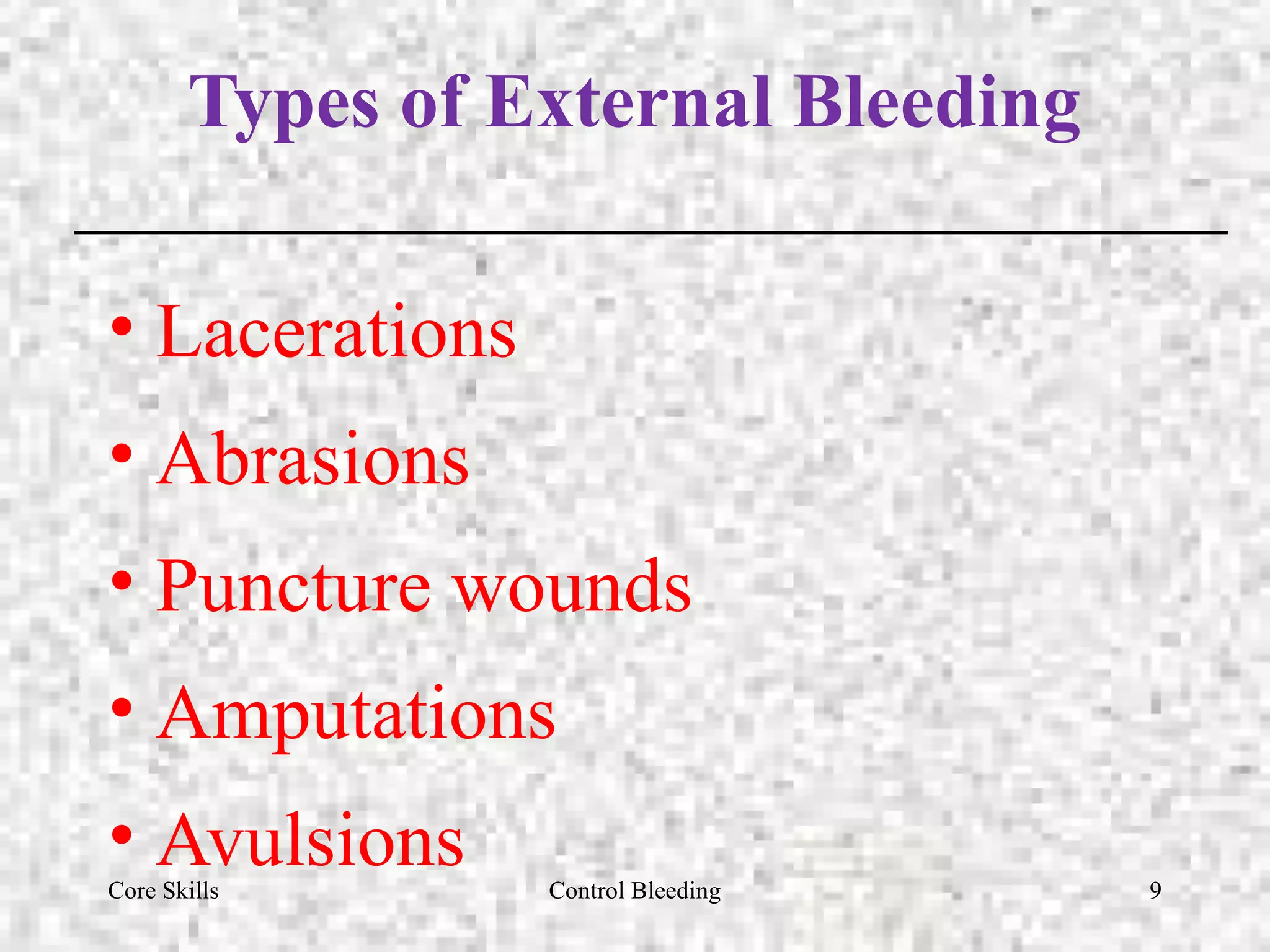 Wounds & Bleeding. Hemorrhage control | PPT