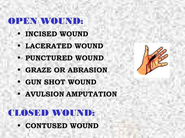Wounds & Bleeding. Hemorrhage control | PPT | First Aid | Injuries