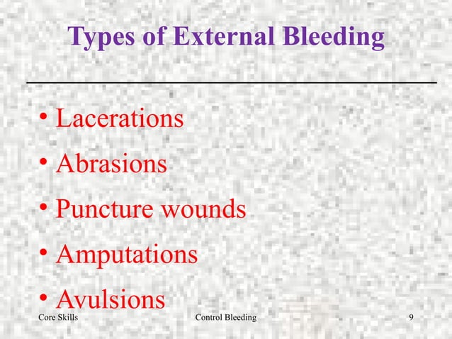 Wounds & Bleeding. Hemorrhage control | PPT | First Aid | Injuries