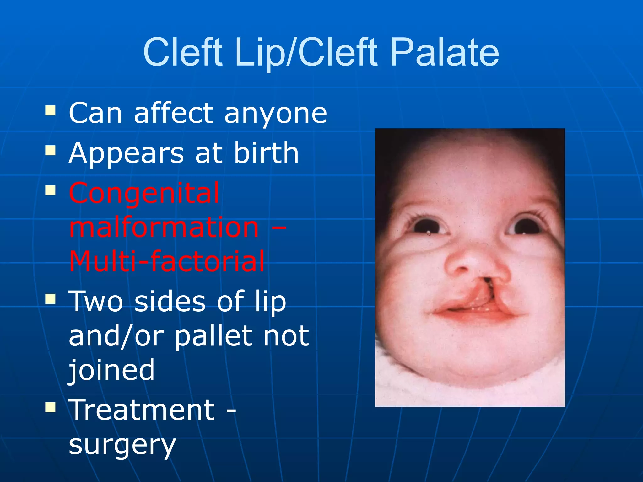 Birth defects | PPT