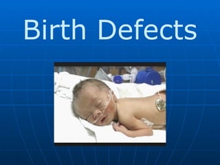 Birth defects | PPT