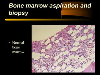 Iron Deficiency Anemia. B12 & Folat Deficiency Anemia | PPT