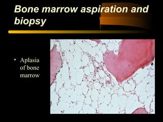 Iron Deficiency Anemia. B12 & Folat Deficiency Anemia | PPT