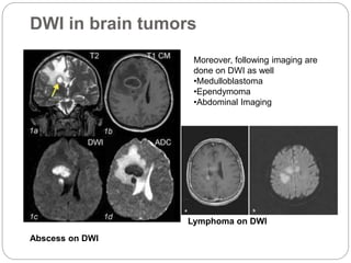 Magnetic Resonance Diffusion | PPTX