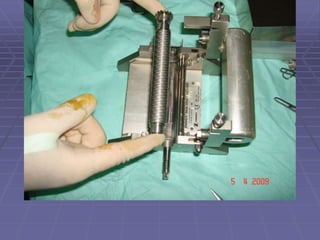 2.plastic surgery | PPT