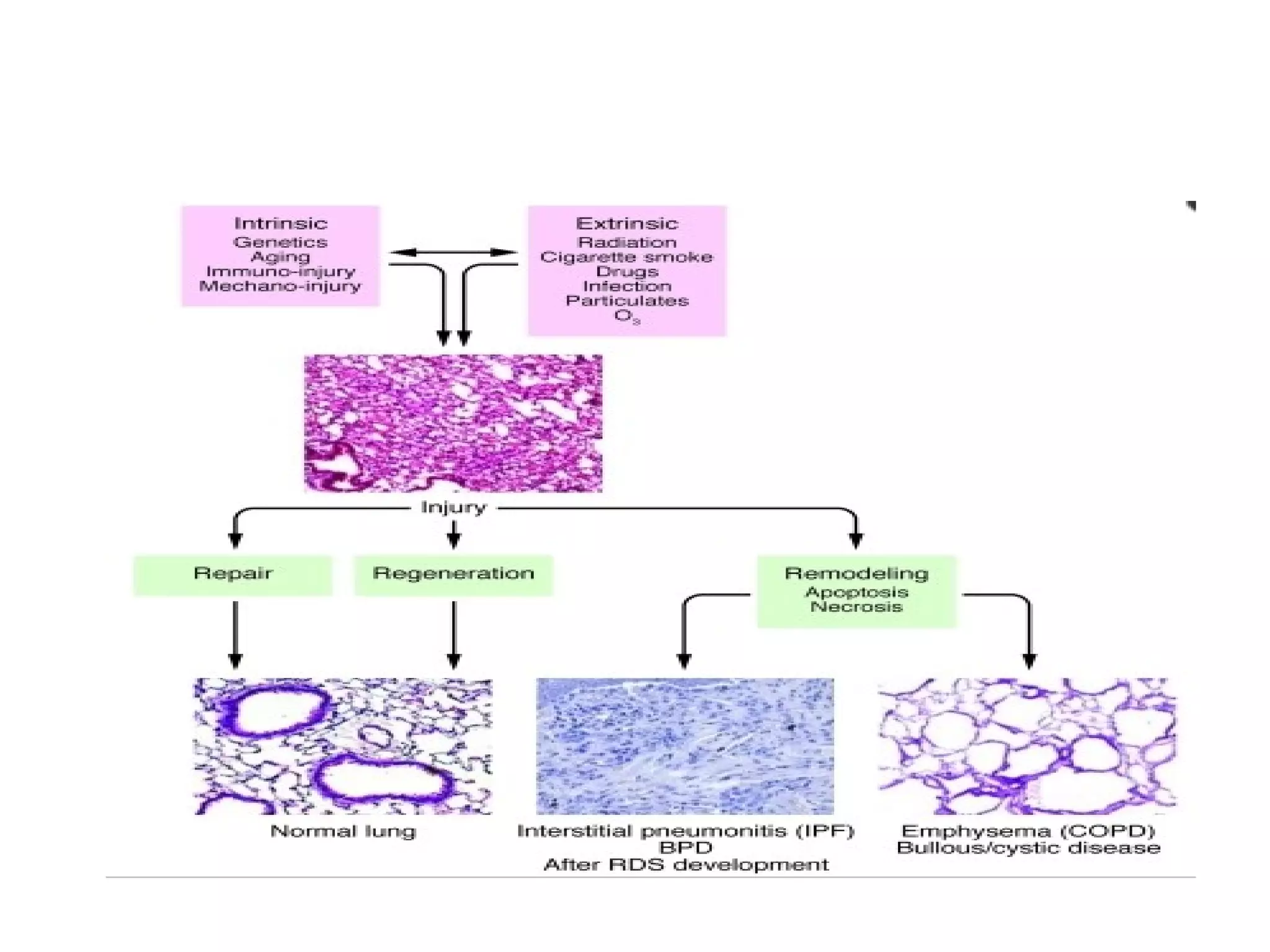 Anatomy and Physiology of Lung Interstitium | PPT