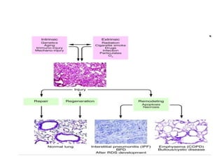 Anatomy and Physiology of Lung Interstitium | PPT