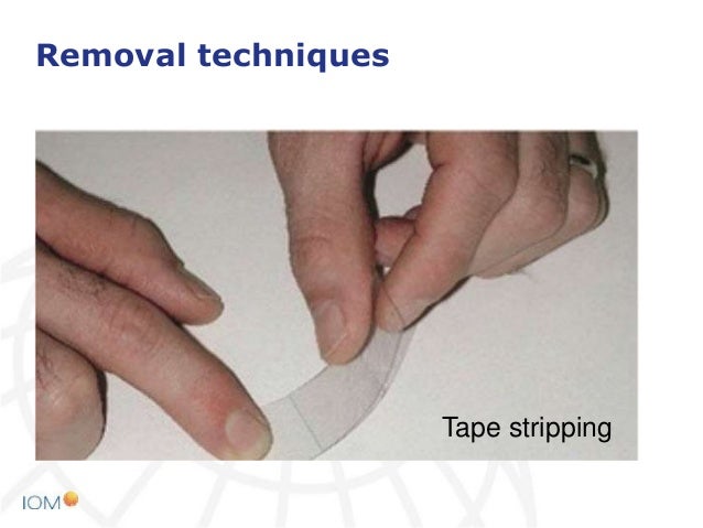 Measurement of dermal exposure - principles and methods