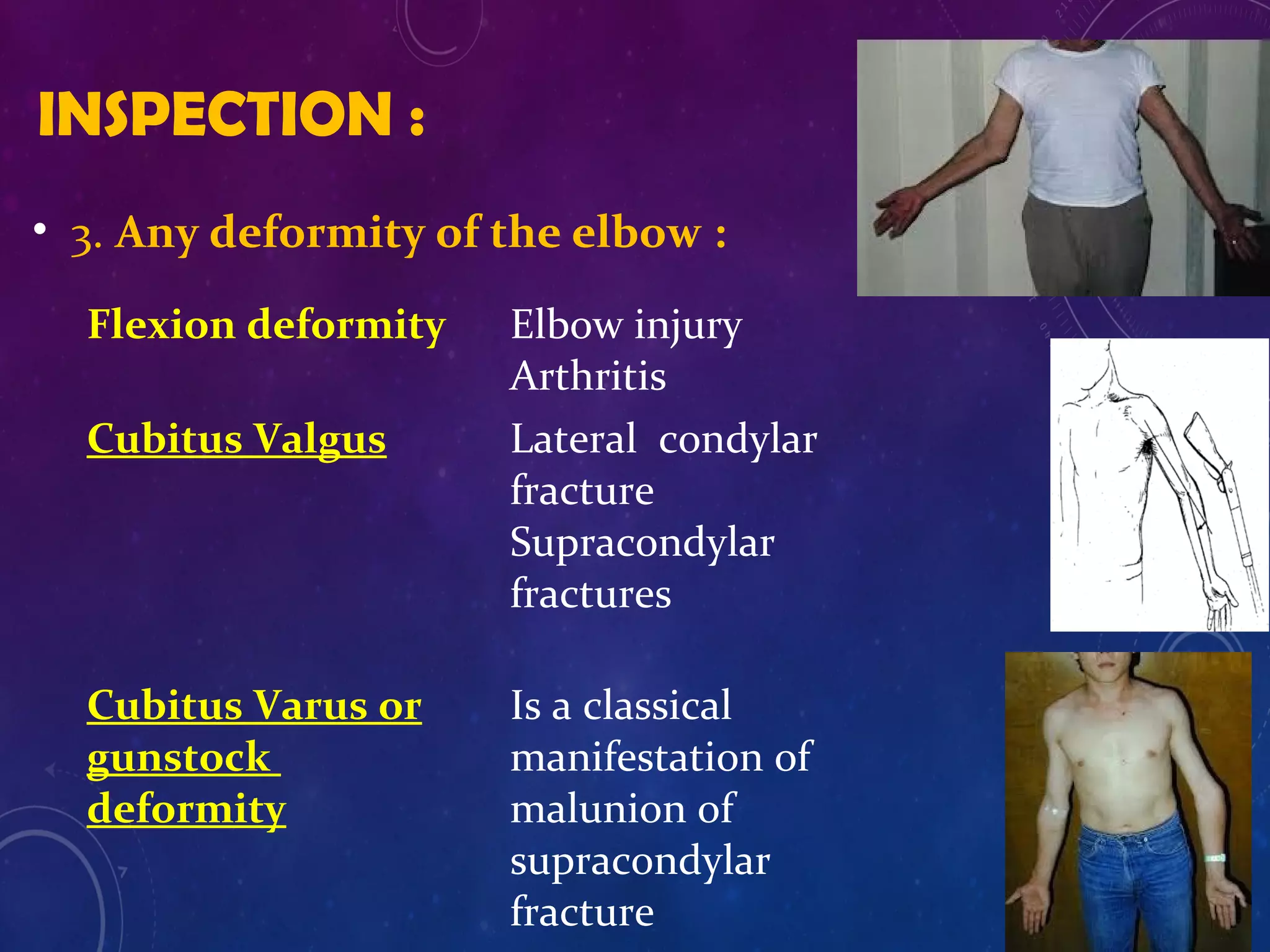 Clinical examination of the elbow | PPT