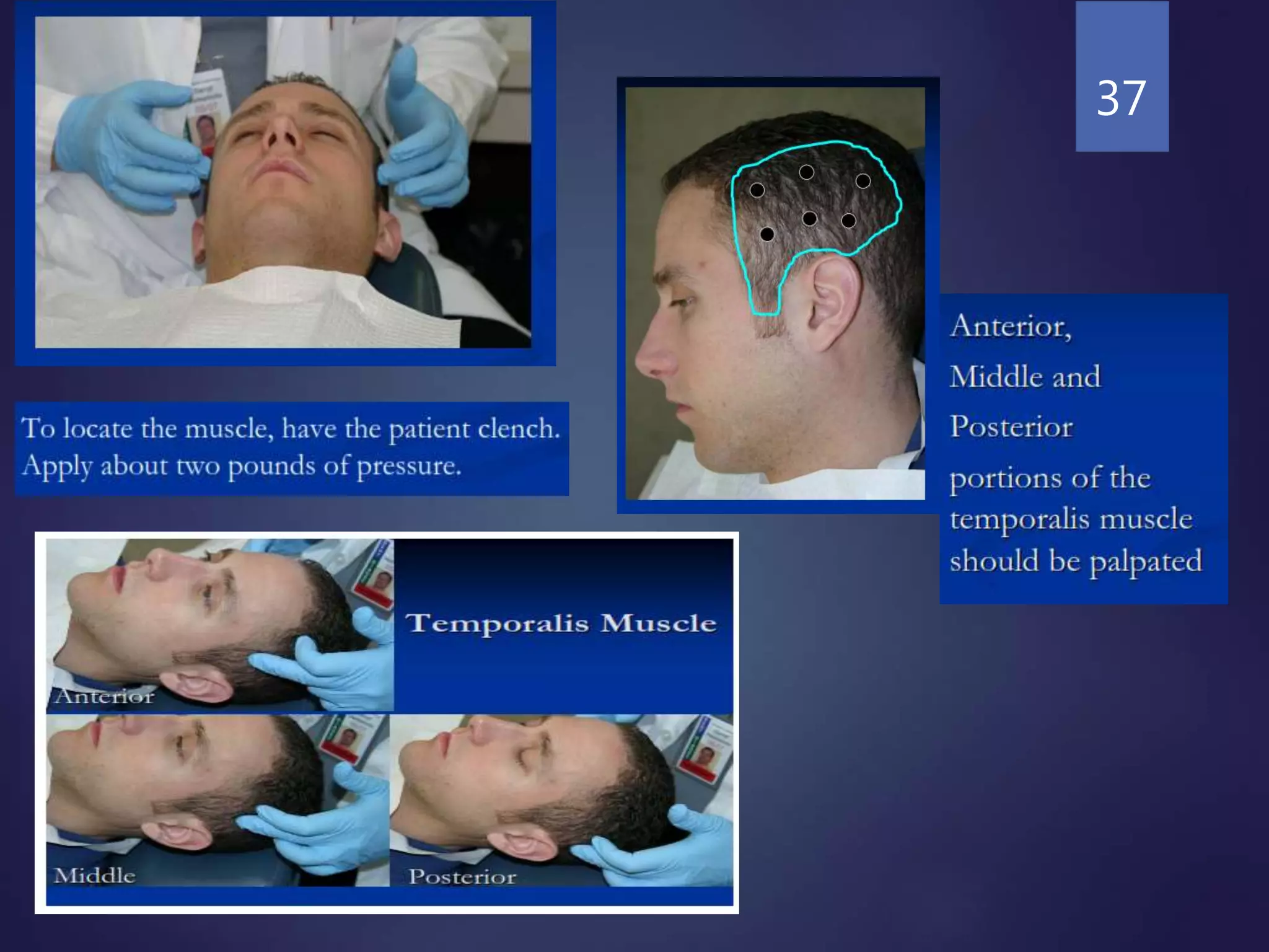 muscles of mastication, dental applications | PPTX