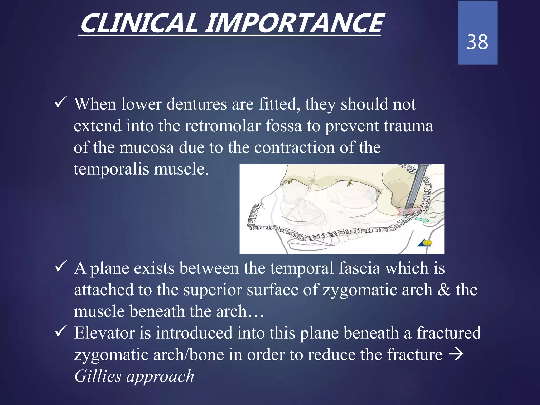 muscles of mastication, dental applications | PPTX