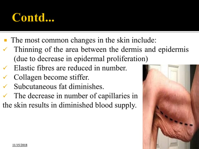 2. physiologic changes in elderly | PDF | Skin and Dermatology ...