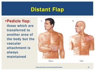 2.1. plastic surgery | PDF