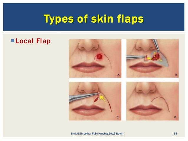 2.1. plastic surgery