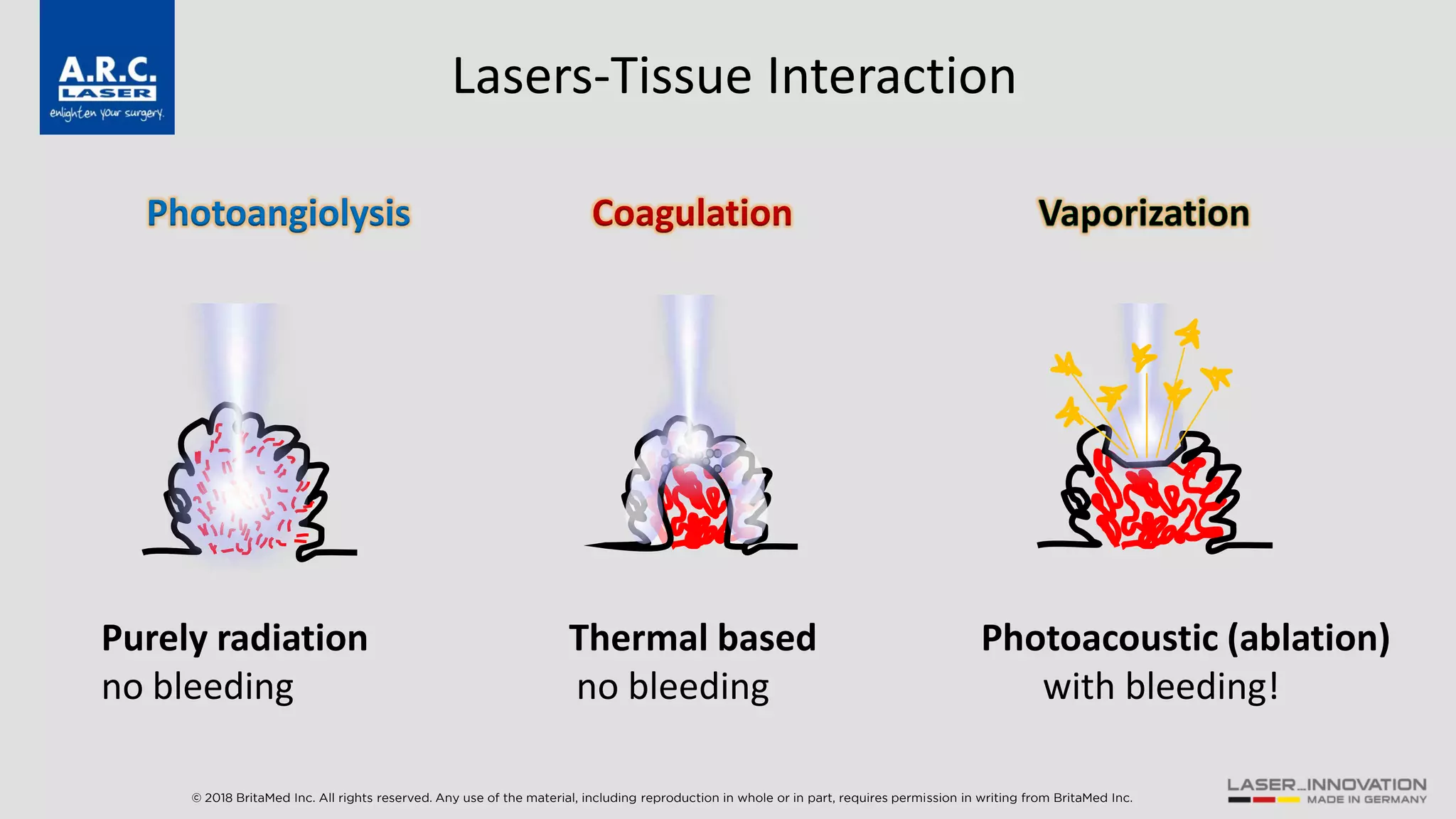 The revolutionary WOLF TruBlue laser | PDF
