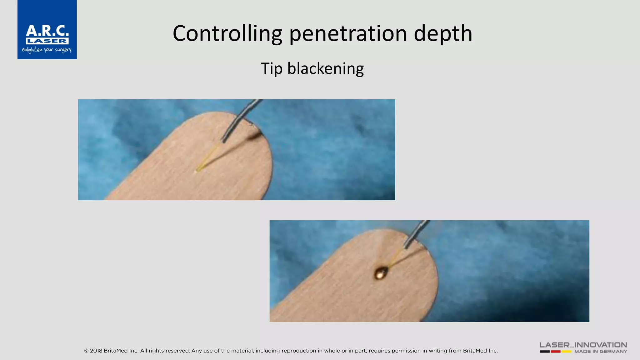 The revolutionary WOLF TruBlue laser | PDF