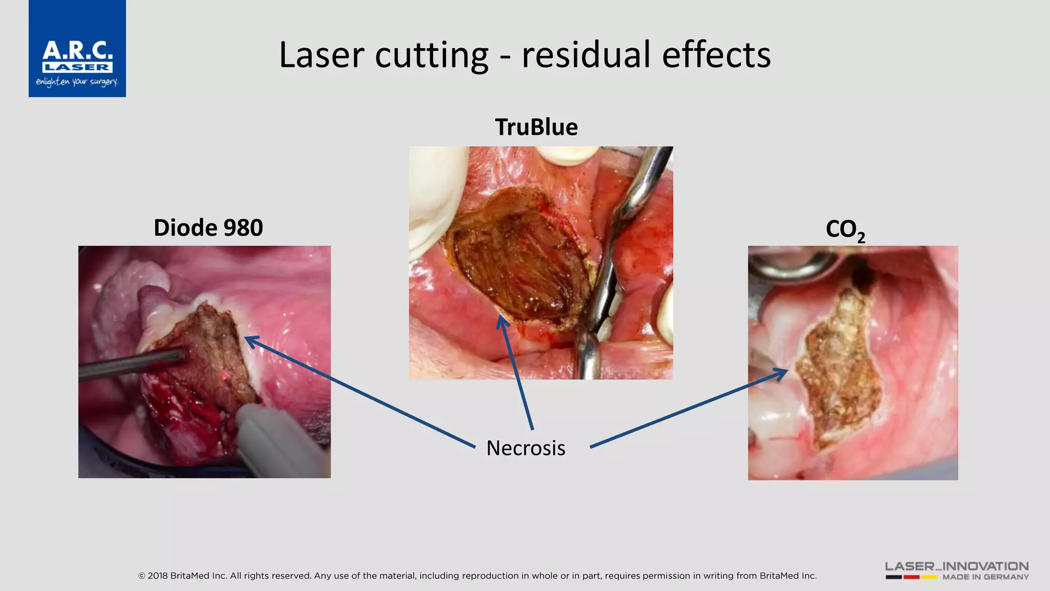 The revolutionary WOLF TruBlue laser | PDF
