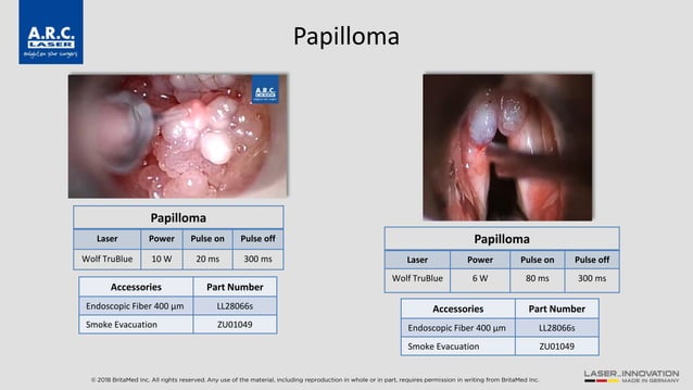 The revolutionary WOLF TruBlue laser | PDF