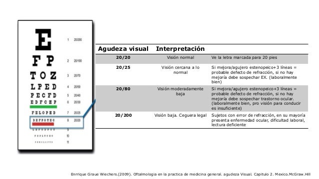2. agudeza visual