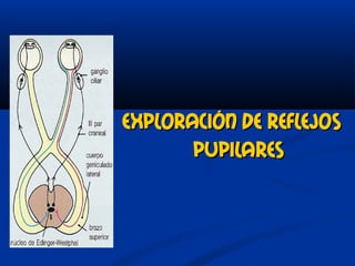 Reflejos pupilares | PPT