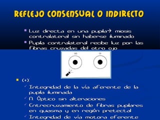 Reflejos pupilares | PPT