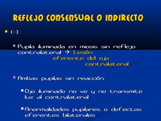 Reflejos pupilares | PPT