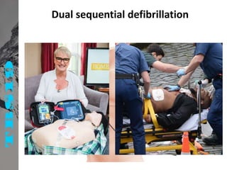 Current controversies in resuscitation | PPT