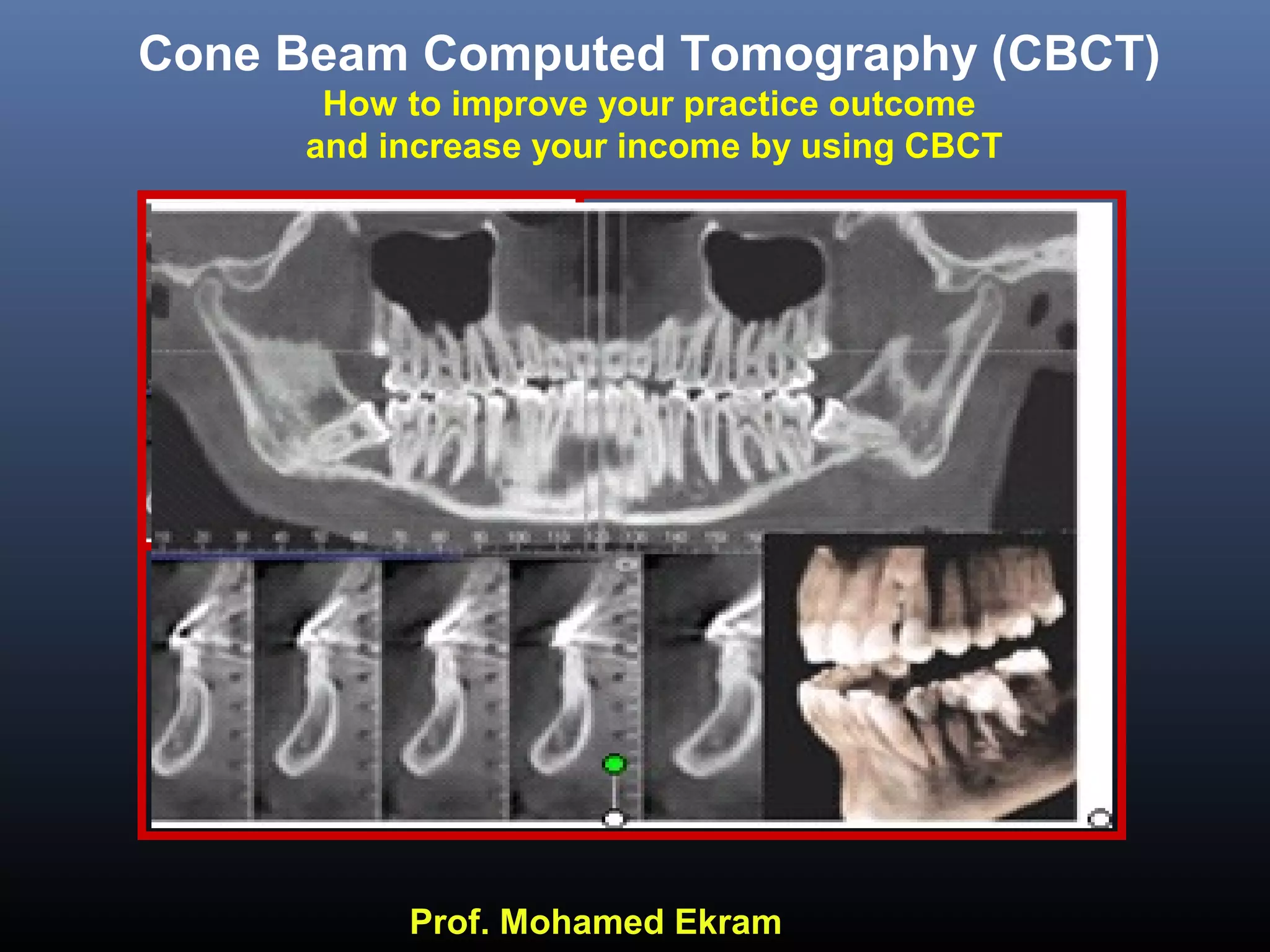 Basic applications of CBCT | PPT