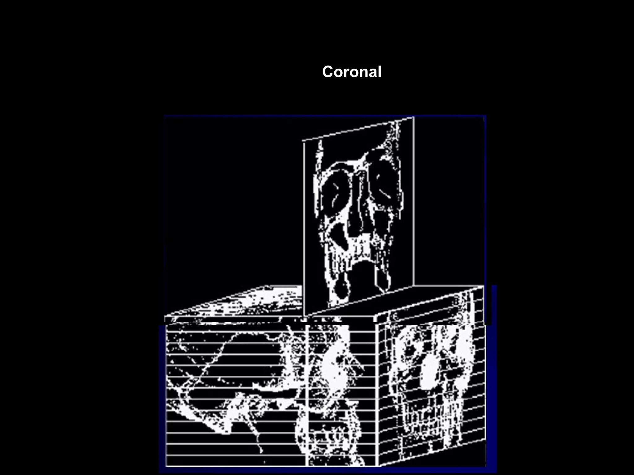 Basic applications of CBCT | PPT