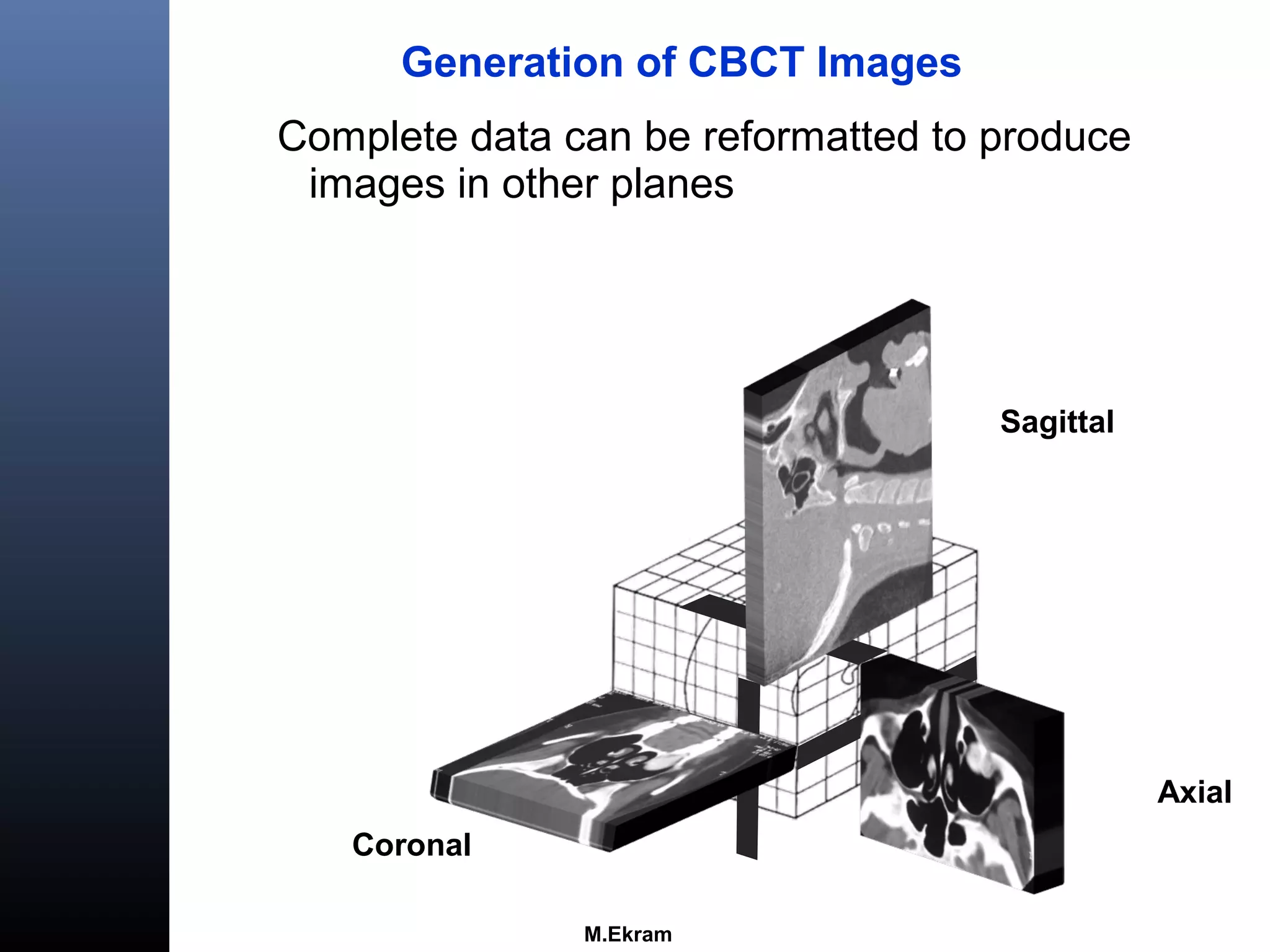 Basic applications of CBCT | PPT