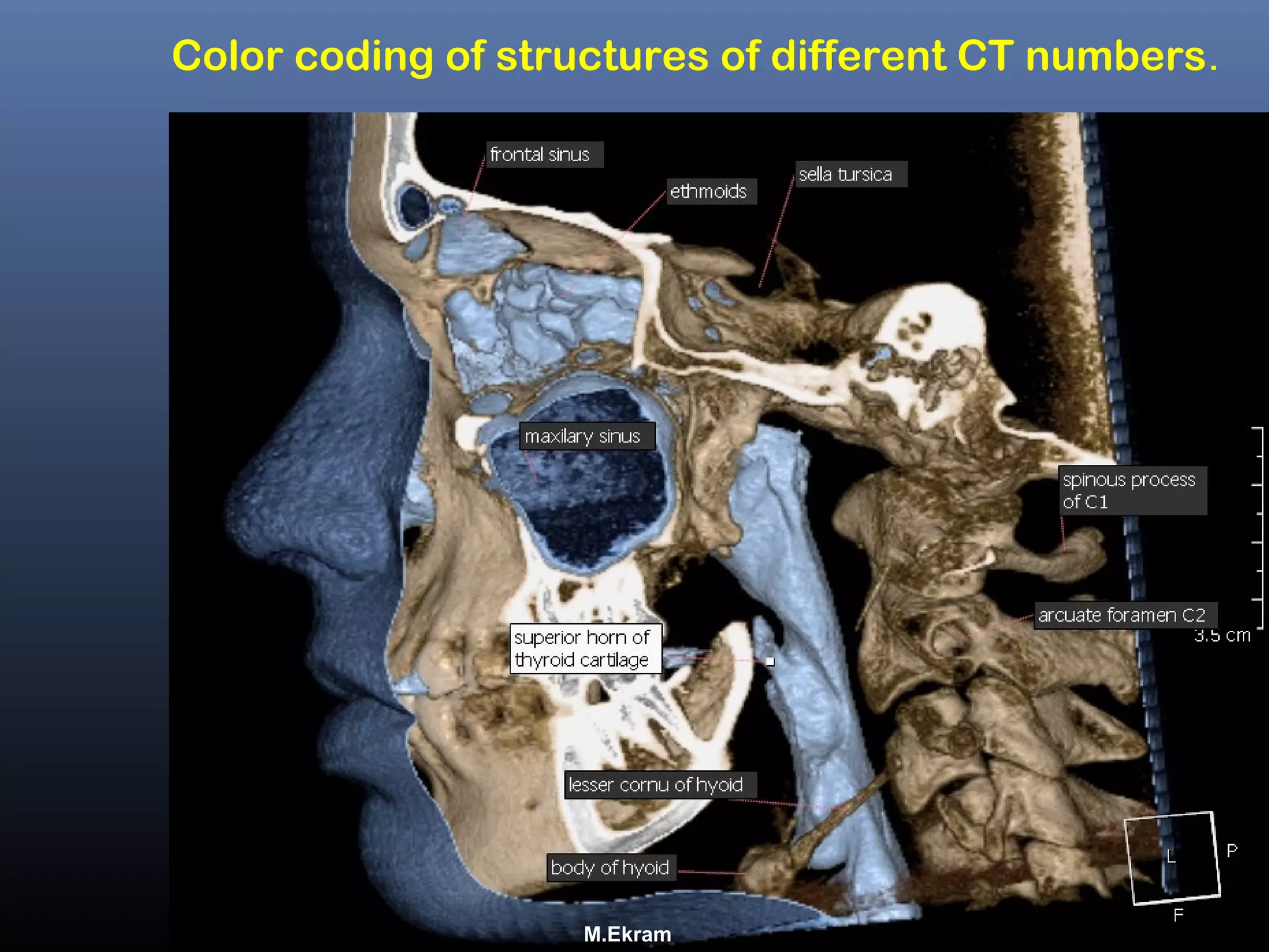 Basic applications of CBCT | PPT