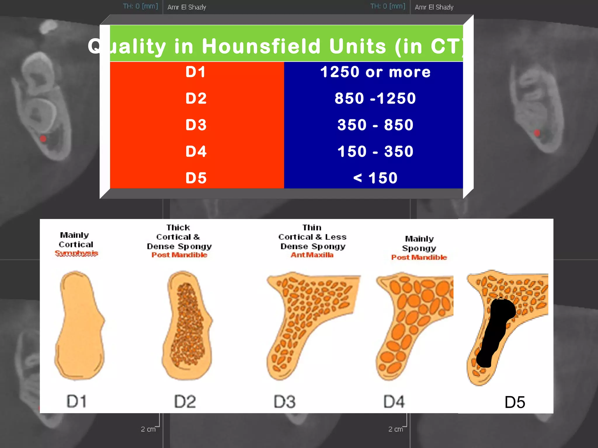 Basic applications of CBCT | PPT
