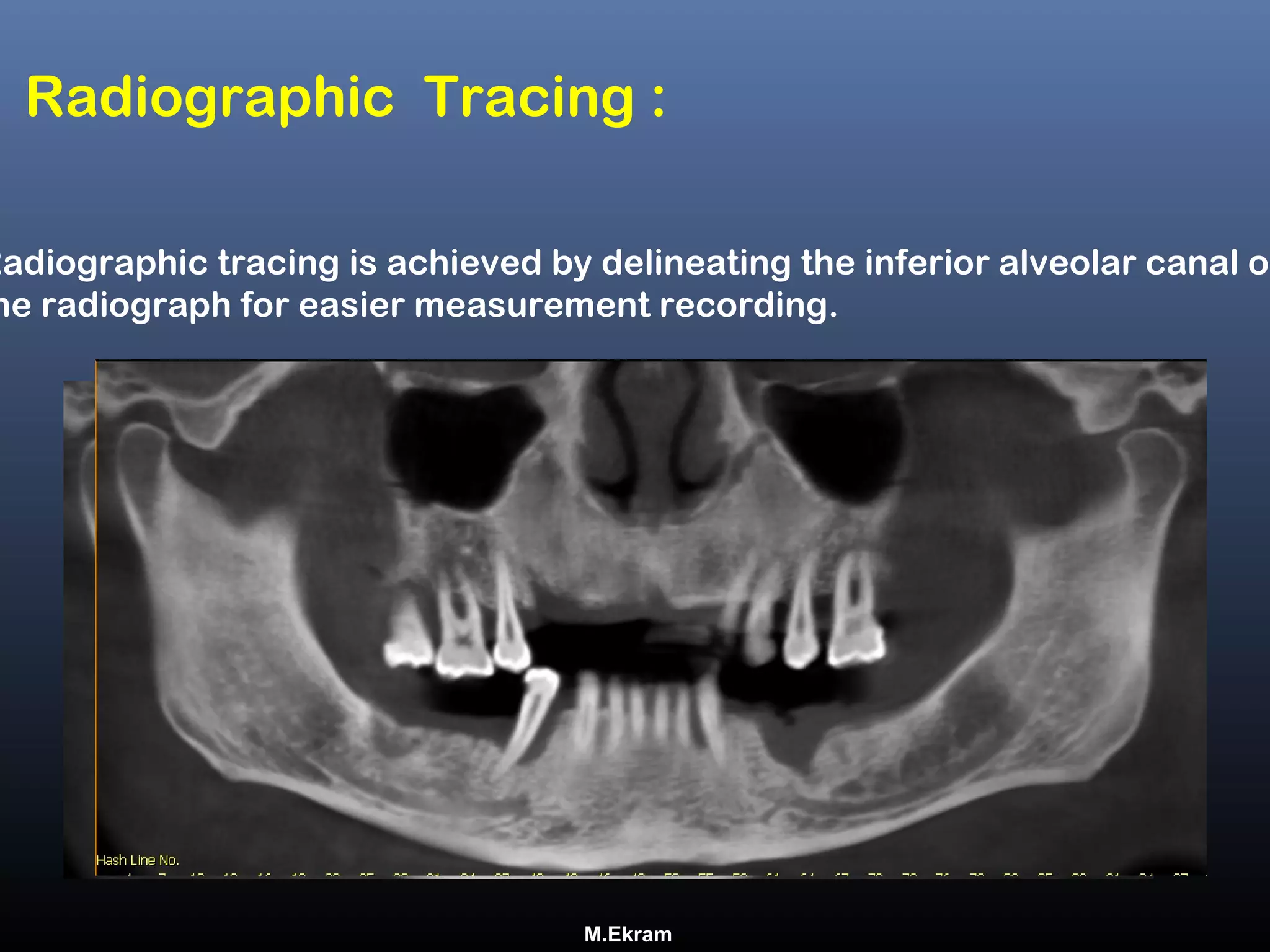 Basic applications of CBCT | PPT