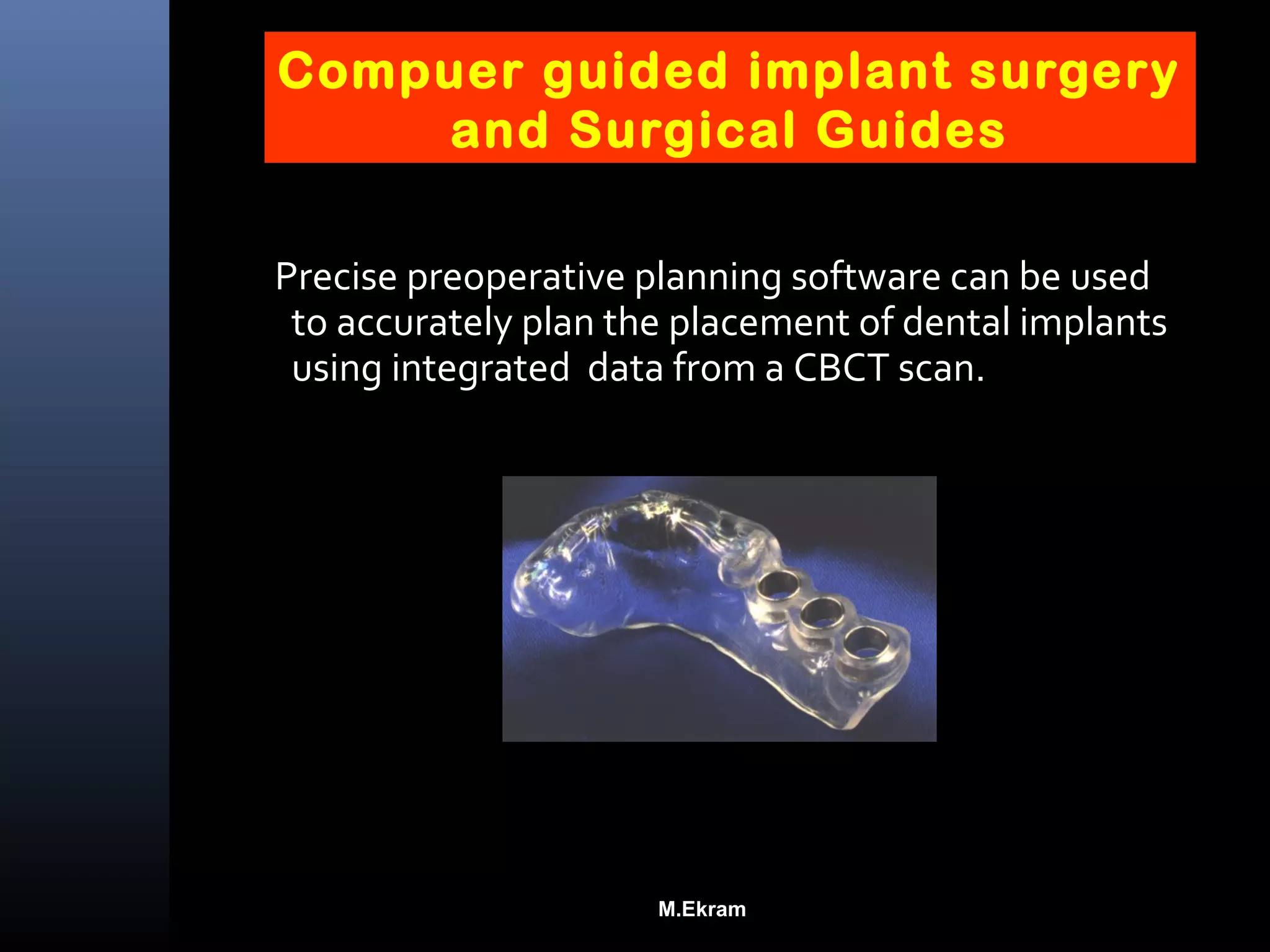 Basic applications of CBCT | PPT